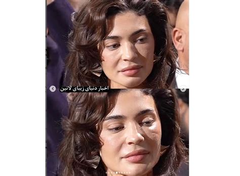 چهره جدید کایلی جنر با اندام و لپ تو رفته برگ همه رو ریختعکس
