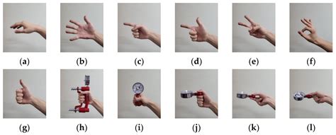 Semg Based Hand Posture Recognition And Visual Feedback Training For The Forearm Amputee