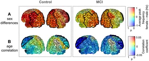 Influence Of Age And Sex On Peak Frequency In Controls And Mcis A