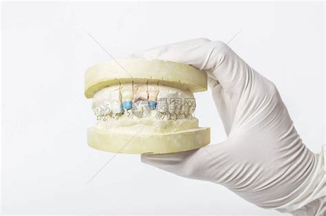 手上的牙齿石膏模型高清图片下载 正版图片505693083 摄图网