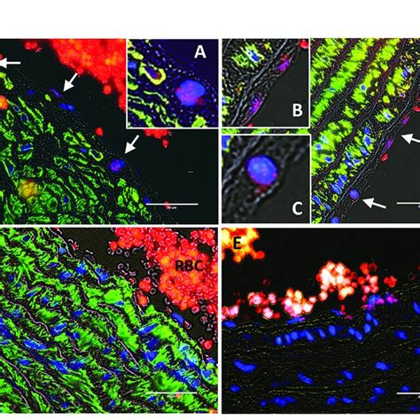 In Situ Detection Of P Gingivalis In Rat Aortic Specimens White