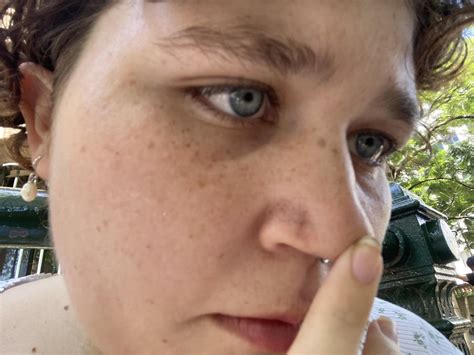 Nostril Piercing Scar Rpiercing