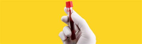 Testosterone Tracking Triglycerides To Hdl And How To Get More