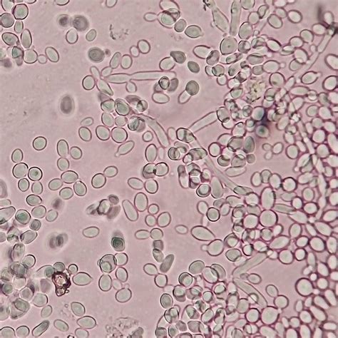 Budding Yeast In Urine