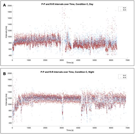 time series of matched time between 2 r peaks in an electrocardiogram