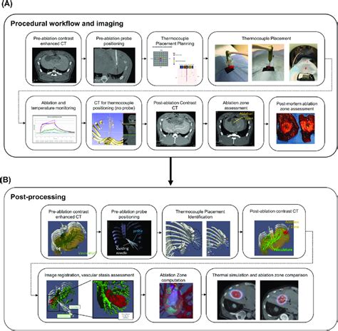 Procedural Workflow Imaging And Post Processing Steps Towards
