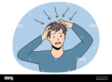 Itchy Head And Dandruff Concept Stressed Irritated Man Standing And Having Itchy Scalp Feeling
