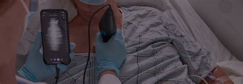 butterfly network point of care ultrasound solutions
