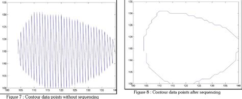 Figure 1 From Finite Element Meshing Of Human Bones From Mri Ct Raw Data Semantic Scholar