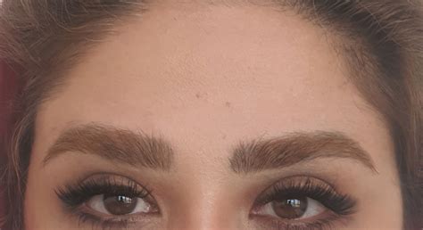 بوتاکس در کرج، ژل لب در کرج، کانتورینگ کرج، کلینیک جهانشهر، بوتاکس نی نی سایت