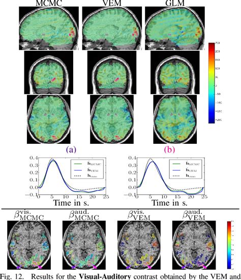 Figure 12 From Fast Joint Detection Estimation Of Evoked Brain Activity In Event Related Fmri
