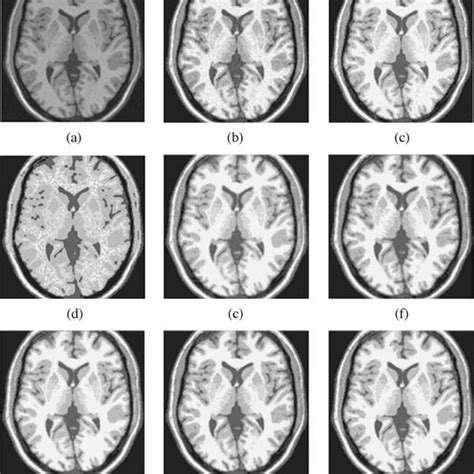 Pdf Robust Image Segmentation Using Fcm With Spatial Constraints Based On New Kernel Induced