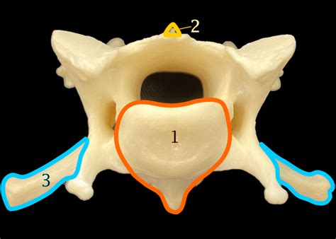 Vertebrae Diagram Quizlet Vertebrae Diagram Quizlet