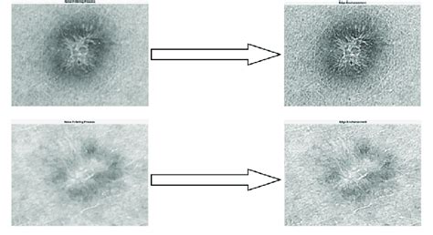 edge enhancement output for dermatofibroma download scientific diagram