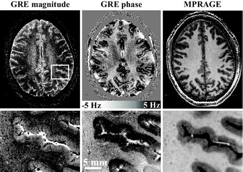 Illustration Of Image Quality Of Mri Based On Image Phase The Download Scientific Diagram
