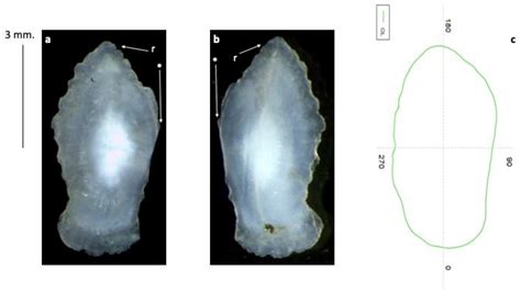 Human Otoliths