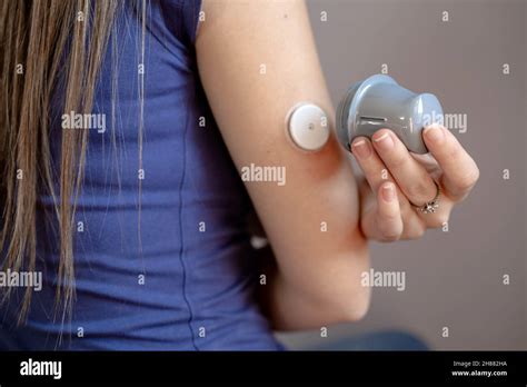 Close Up Of Girl Applying Flash Glucose Monitoring Patch On Her Arm