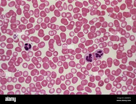 Micrografia Luce Di Cellule Del Sangue Umano Che Mostra Numerosi Globuli Rossi Eritrociti E