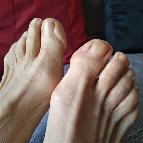 ΛΥΡΙΣΜΟΣ ΣΤΑ ΠΟΔΙΑ ΣΟΥ Oikoi2310