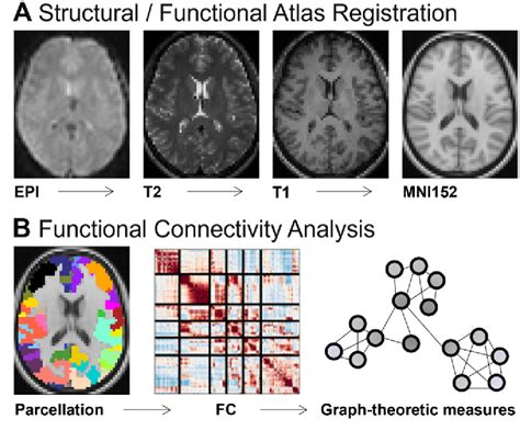 Figure 1 From Optimal Approaches To Analyzing Functional Mri Data In
