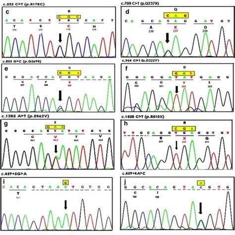 Sequence Chromatogram Of Hexa Gene Mutations A C 426delt