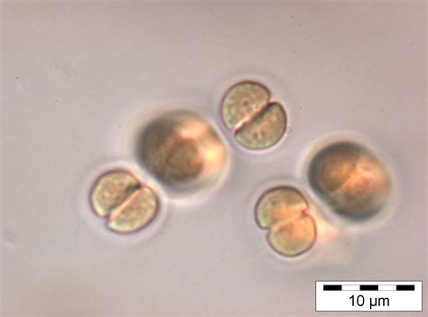 Chroococcus Limneticus
