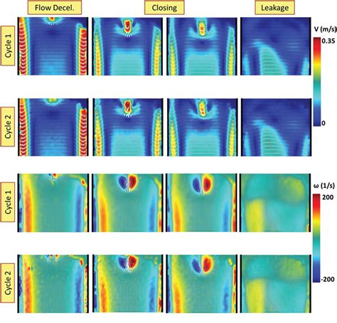 Figure 1 From Design Of A Pulsatile Flow Facility To Evaluate Thrombogenic Potential Of