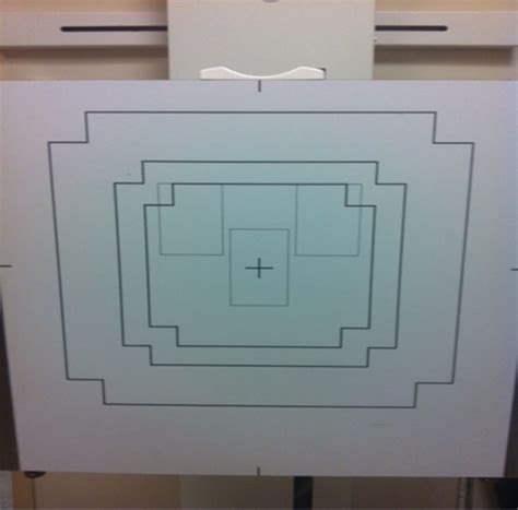 W3 Pp2 Exposure Technique Selection Flashcards Quizlet