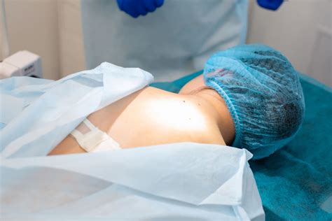 The Best Doctor For Pilonidal Cyst Surgery Pilonidal Expert
