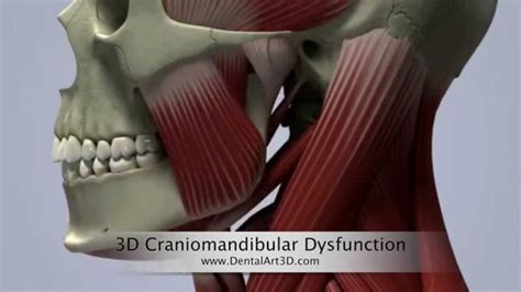 Dentalart3d 3d Craniomandibular Dysfunction