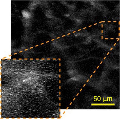 High Performance Multiphoton Excitation Microscope Using Slm Optical Information Processing And