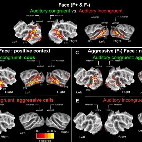 Auditory Activations Depend On Semantic Congruence With Visual