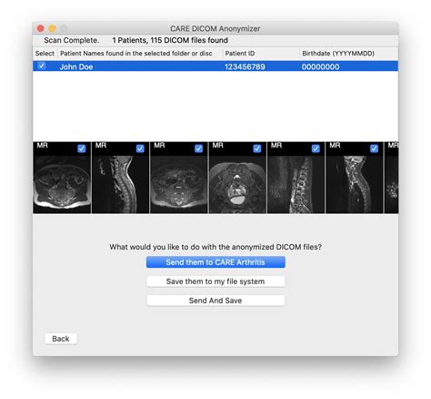 CARE DICOM Anonymizer Help