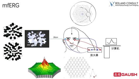 临床视觉电生理丨多焦erg标准化指南解读 会议预告 法大法庭科学技术鉴定