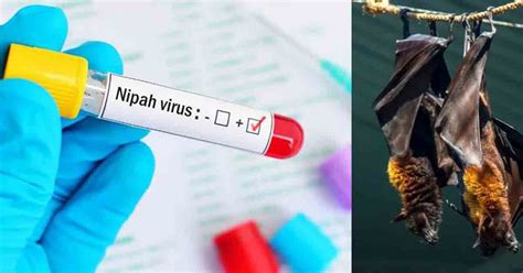 Breaking Nipah Virus Outbreak In Kerala Intensifies Sixth Case Reported Pune Pulse