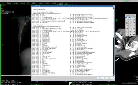 Pacs系统源码，大型医院pacs源码集成三维重建