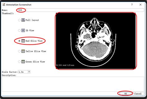 请教各位老师3d Slicer中如何保存图片？ 6，来自 Caoyufu 问题求助 3dslicer中文论坛
