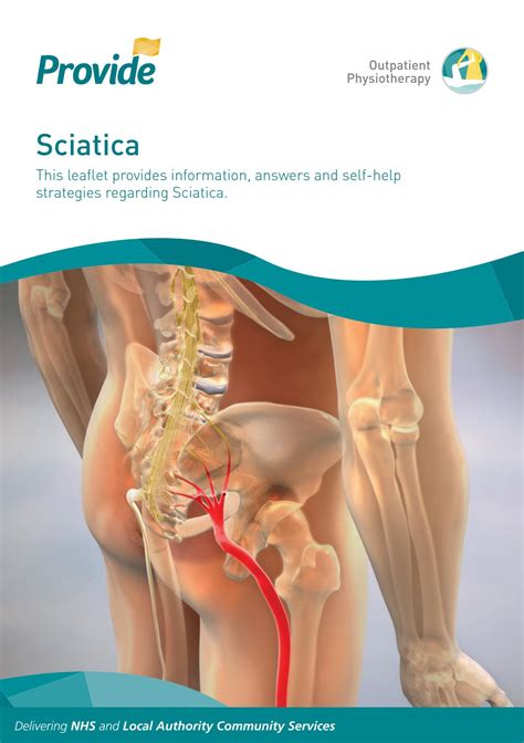 Sciatica Leaflet By Provide Cic Issuu