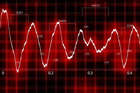 宫缩频率变化规律 39健康网 产科