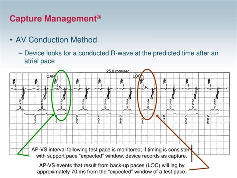 Ppt Pacemaker Automatic Features Module 10 Powerpoint Presentation