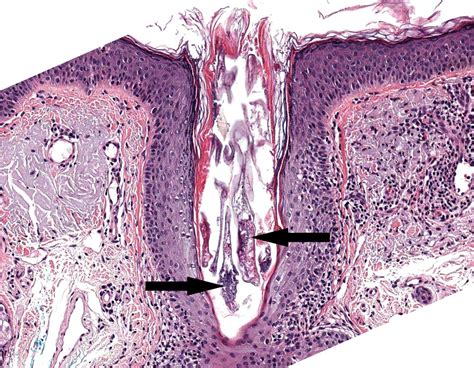 Pathology Outlines Histology