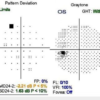 Humphrey Visual Field Plot Post Treatment On Th Day Of Download Scientific Diagram