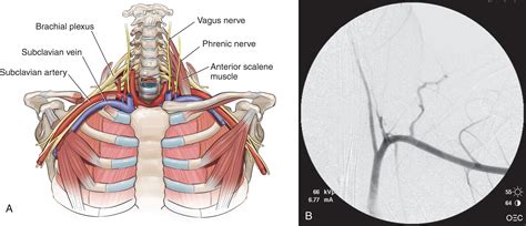 Upper Extremity And Junctional Zone Injuries Clinical Tree