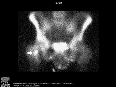 Case Of The Month Canadian Association Of Radiologists Journal Ppt Download