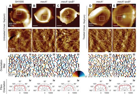 Science：新研究揭示超级细菌mrsa抵抗抗生素的双重防御机制 生物科技 健康一线资讯