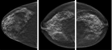 Figure 1 From Laplacian Based Blur Detection Algorithm For Digital
