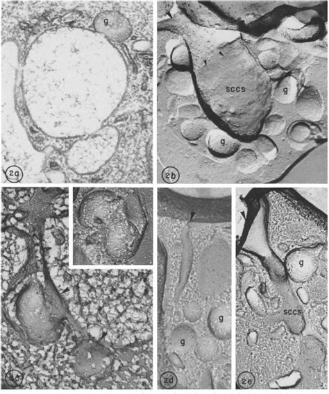 Figure 1 From Alpha Granules Their In Platelets Semantic Scholar