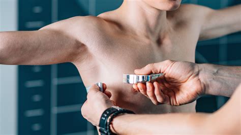 Pectus Excavatum Diagnosis And Treatment