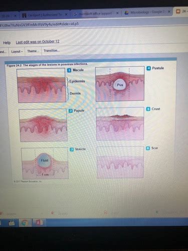 Chapter Flashcards Quizlet