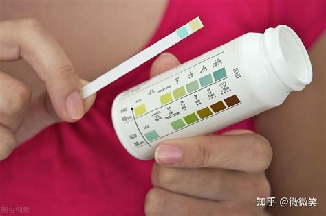 尿蛋白加号 怎样换算为24小时尿蛋白定量进来对照一下 知乎